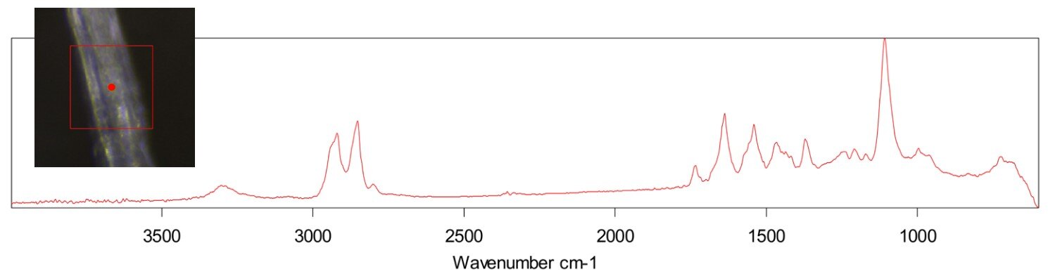 IL-21: Fourier transform infrared microscopy (FTIR microscopy)